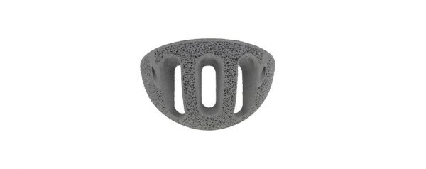 Implantcast - Quadril - EPORE® acetabulum spacer - Ortospine